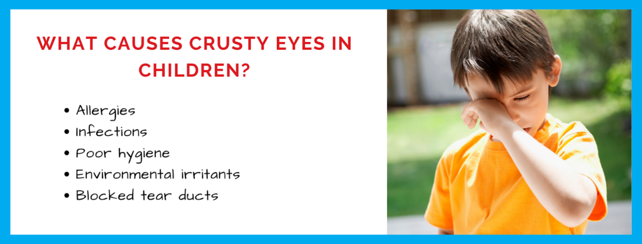 Crusty Eyes in Children: What Every Parent Needs to Know