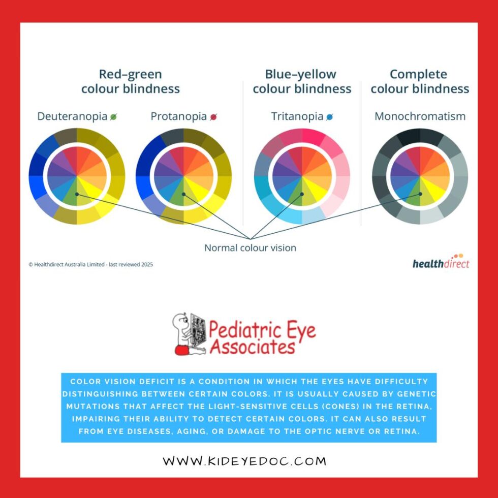 Color Blindness in Children - Pediatric Eye Associates, LLC